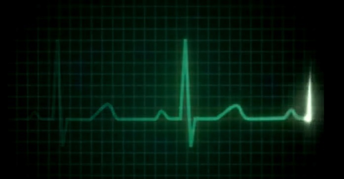 'Potential societal impact': Revolutionary heart attack sensor ...